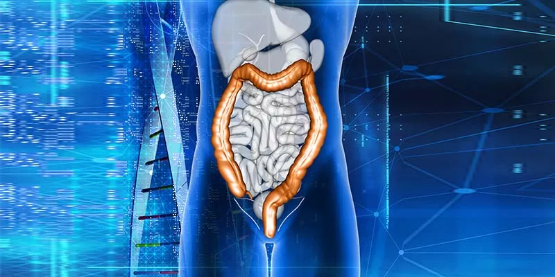 What Is Abdominoperineal Resection Surgery? | Rectal Cancer Surgery