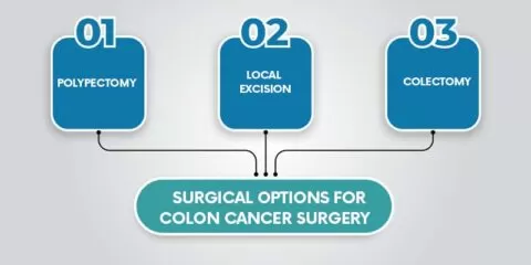 What Are the Types of Colon Cancer Surgery?